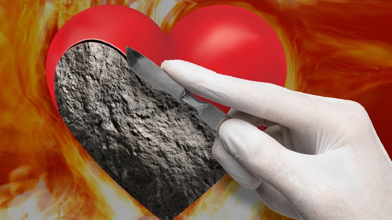 Circumcision of the Heart | Emmanuel Waupun