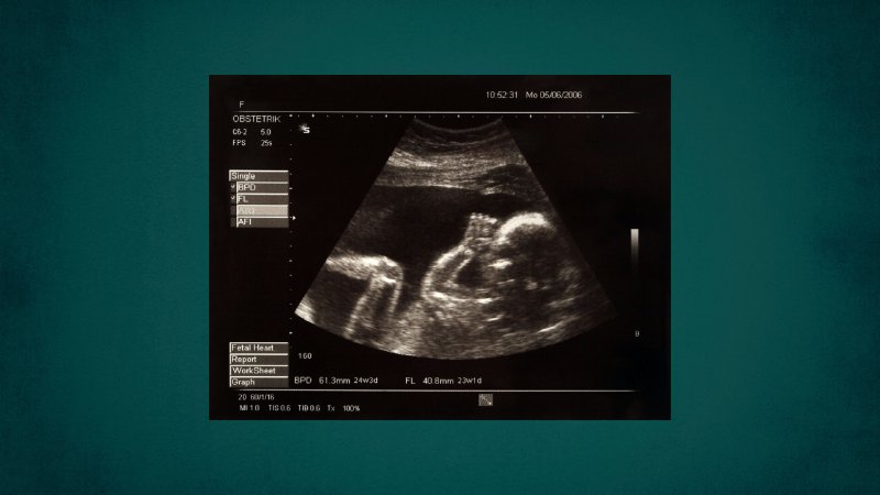 The Value of a Life | First Baptist Church Muskogee